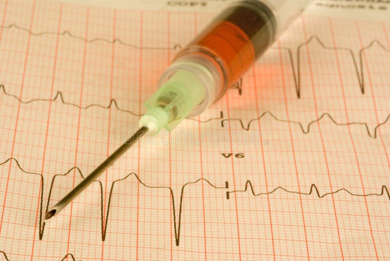 Ekg Strip Stock Photos - Free & Royalty-Free Stock Photos from Dreamstime