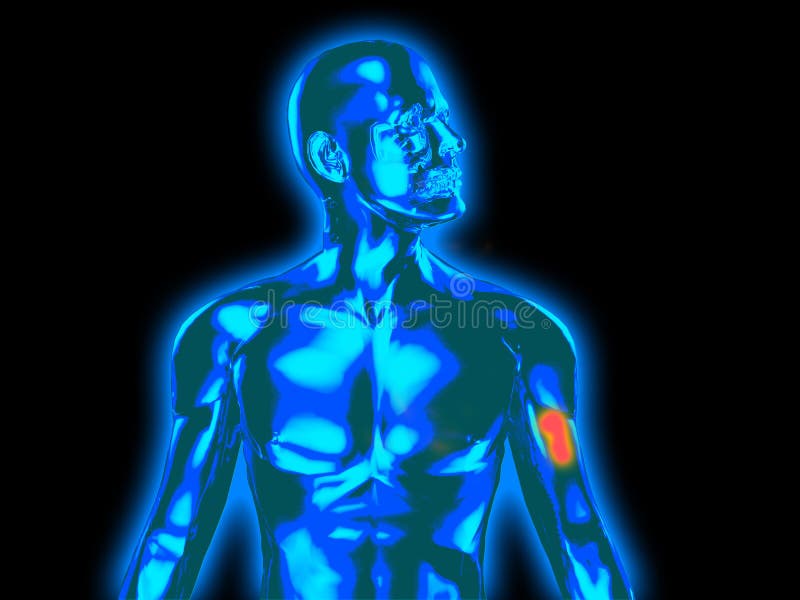 Pain Injection Stock Illustrations – 1,289 Pain Injection Stock ...