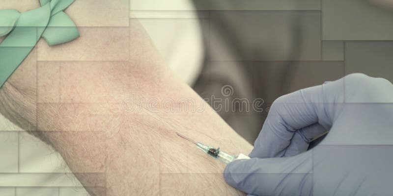 Injection of a Catheter in the Arm, Geometric Pattern Stock ...
