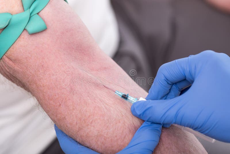 Injection of a Catheter in the Arm Stock Image - Image of needle ...