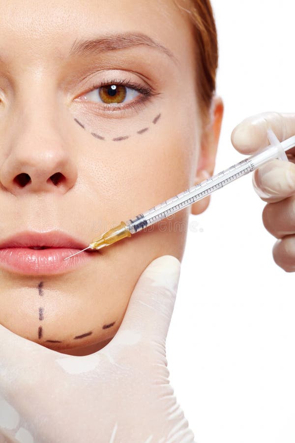 Injection of collagen stock photo. Image of looking, cosmetic - 25939738