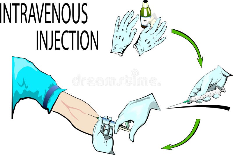 Injection Stock Illustrations, Vecteurs, & Clipart – (81,517 Stock ...