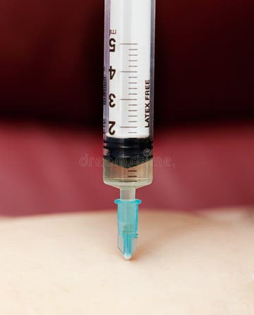 Buttock Injection Stock Photos - Free & Royalty-Free Stock Photos from ...