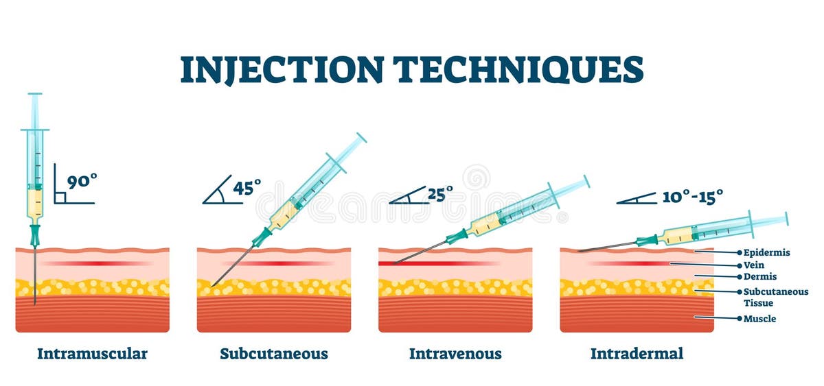Injection Stock Illustrations – 91,247 Injection Stock Illustrations ...
