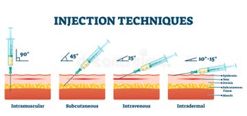 Injection Stock Illustrations – 84,073 Injection Stock Illustrations ...