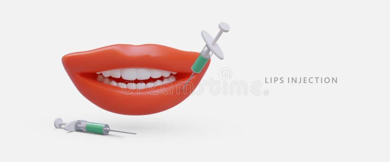 Injections in Lips. Cosmetic Correction, Lip Augmentation Stock Vector ...