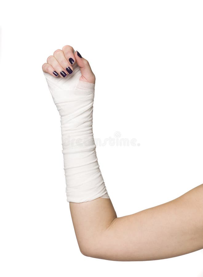 Injured arm stock photo. Image of damage, injury, white - 9098304