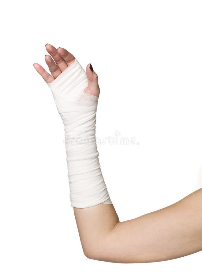 Broken arm and fingers stock photo. Image of taped, injured - 23385898