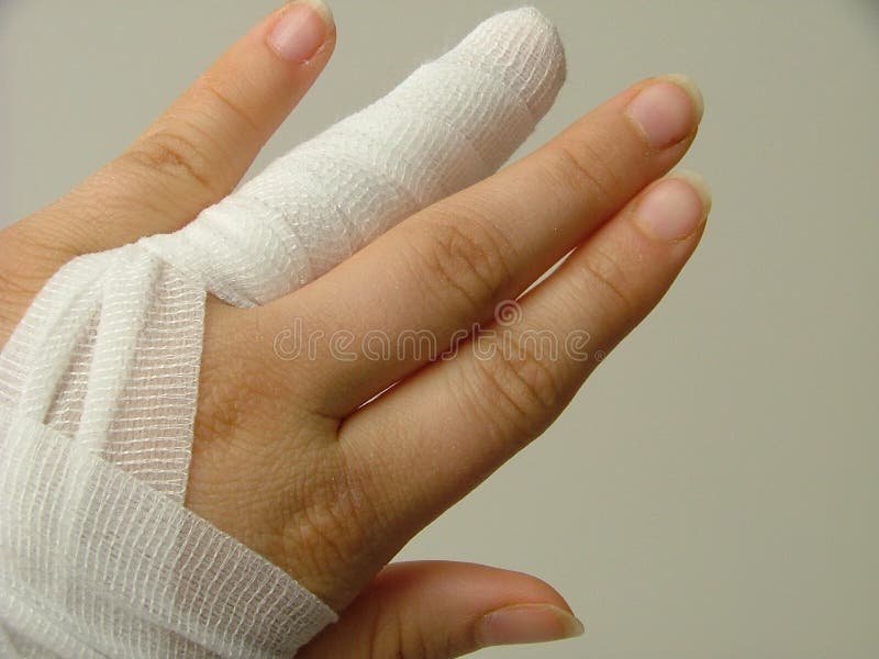 Injured finger stock image. Image of broken, protection - 141597