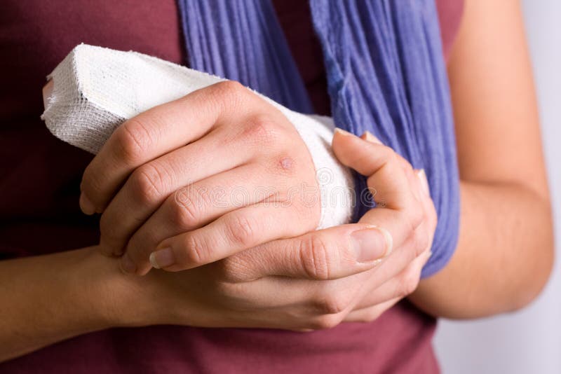 Injured Hand stock image. Image of patient, glove, person - 16393343