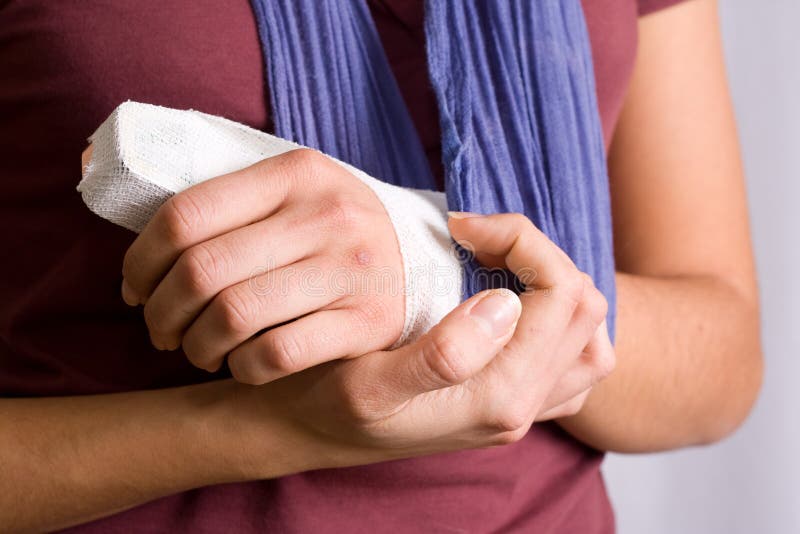 Injured hand stock photo. Image of help, injuried, fracture - 12661030