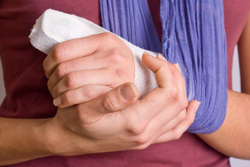 Injured hand stock photo. Image of physical, health, treat - 12661038