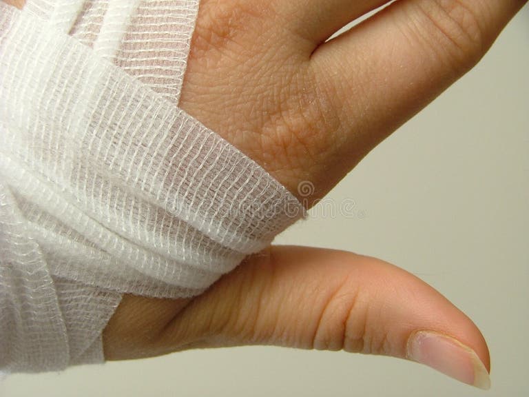 Injured hand stock photo. Image of white, digit, bond, finger - 141590