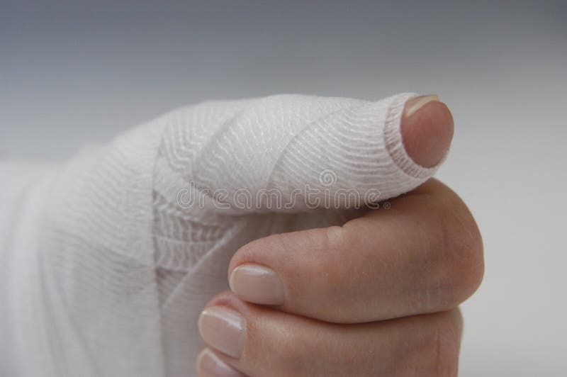 Injured hand stock image. Image of thumb, patient, pain - 5715281