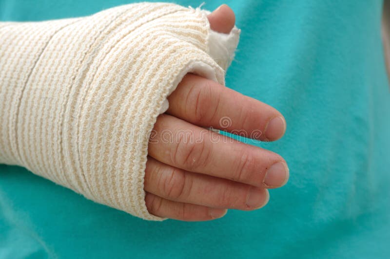 Injured hand stock photo. Image of white, digit, bond, finger - 141590
