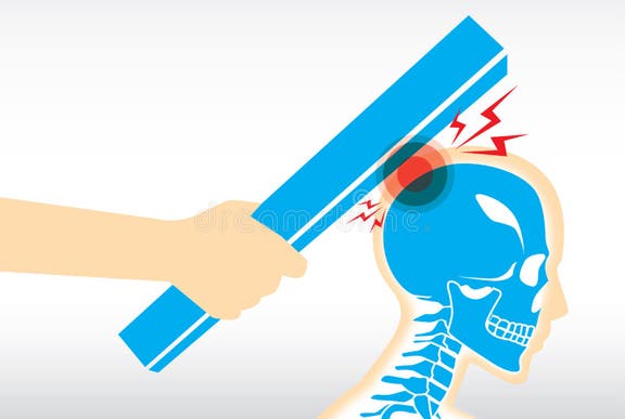 Cartoon Hit Head Stock Illustrations – 602 Cartoon Hit Head Stock ...