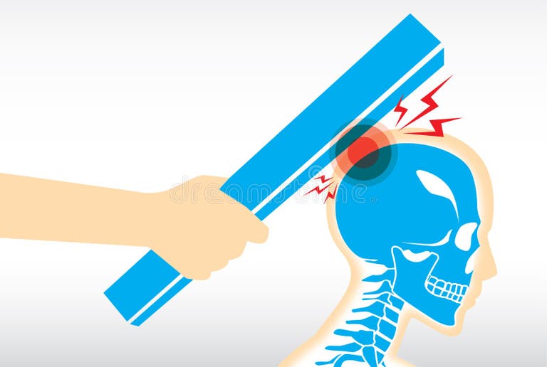 Cartoon Hit Head Stock Illustrations – 602 Cartoon Hit Head Stock ...