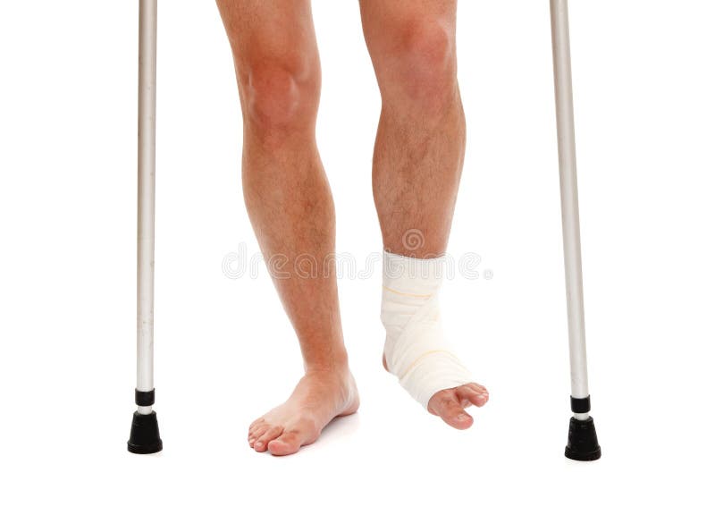 Injured leg stock image. Image of protection, injury - 21851623