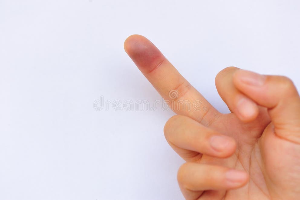 Injuried middle finger stock photo. Image of chinese - 61045582