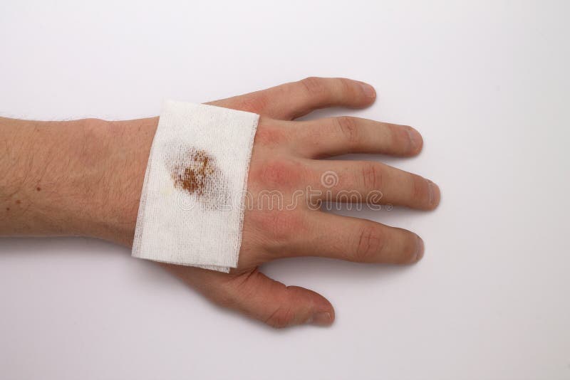 Injury stock image. Image of medicine, physician, emergency - 37368513