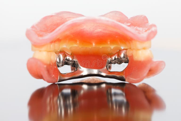 Inner Relation of Dental Prostheises Stock Photo - Image of fixate ...
