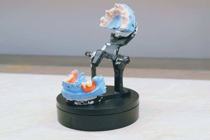 Innovative Denture Model Highlighting Precision Craftsmanship Stock ...