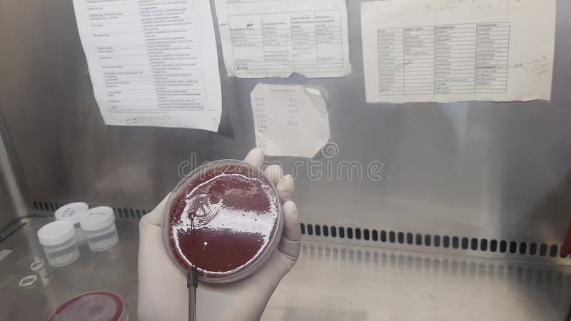 Inoculation of Sample in a Blood Agar Culture Plate by an Inoculation ...