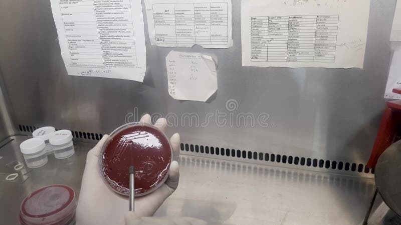 Inoculation of Sample in a Blood Agar Culture Plate by an Inoculation ...