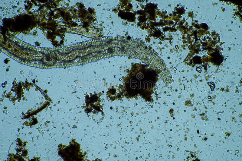 Insect Parasite in the Soil in Australia Stock Photo - Image of ...