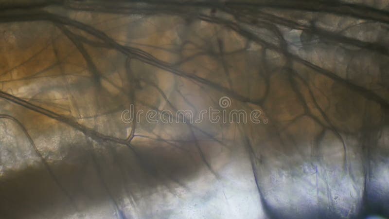 Micro Body Cell Explosion. Burst of Body Cell. Alpha Channel Stock ...