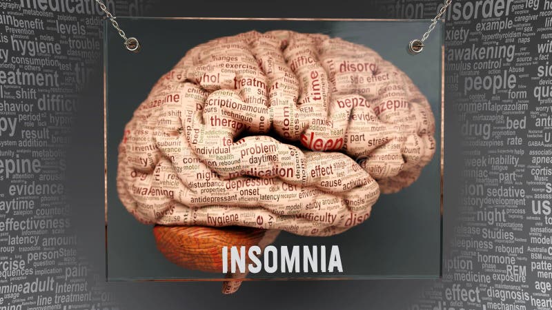 Insomnia in human brain stock illustration. Illustration of concepts ...