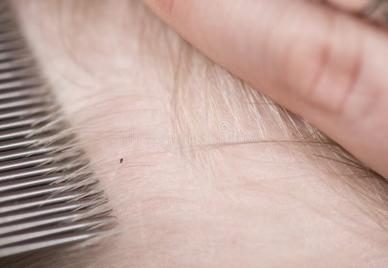 Inspecting Childs Head for Lice Stock Image - Image of caucasian ...