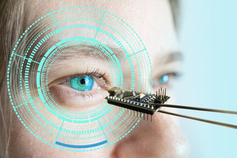 Installing Electronic Chip into Human Bionic, Neuroprosthetic Eye ...