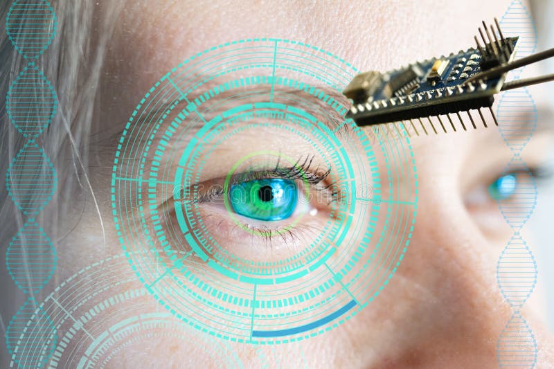Installing Electronic Chip into Human Bionic, Neuroprosthetic Eye ...