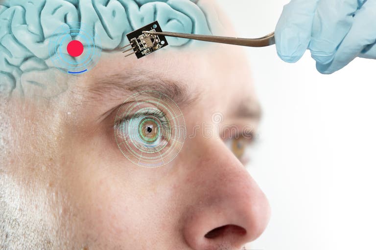 Installing Electronic Chip into Human Brain, Applied in Various Fields ...