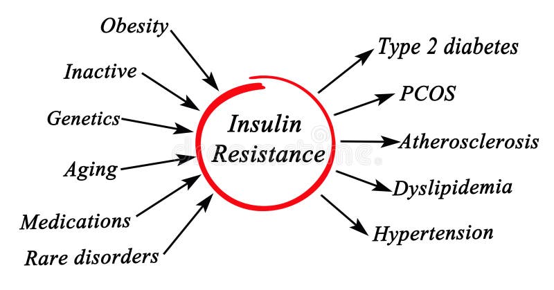 Insulin Resistance stock illustration. Illustration of aging - 84310627