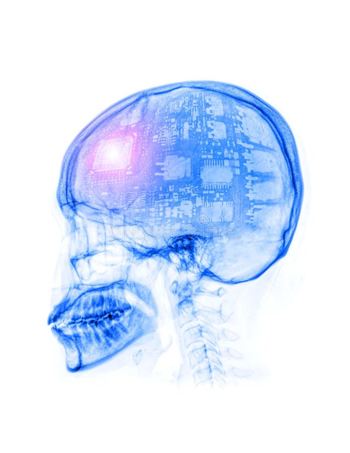 Intellectual Thinker , Human Skull X-ray with CPU for Technology ...
