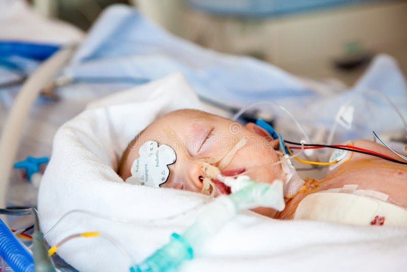Intensive care, child stock image. Image of care, wires - 64438011
