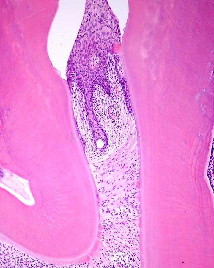 Junctional Epithelium Stock Photos - Free & Royalty-Free Stock Photos ...