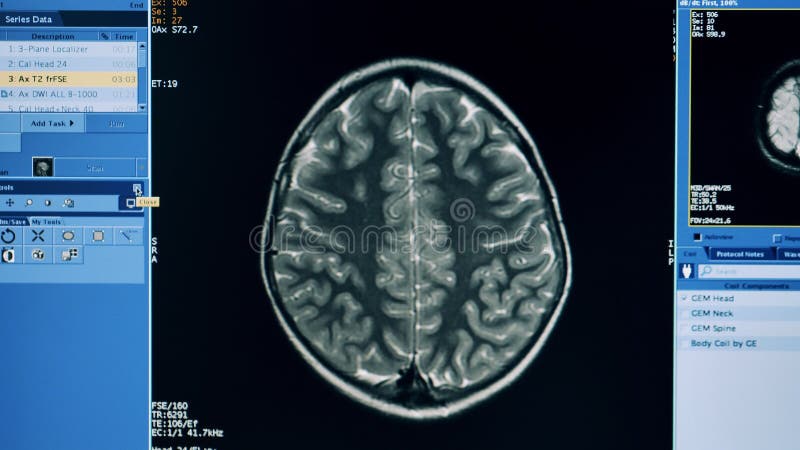 Interface of an MRI Computer Program during Head Scanning Stock Video ...