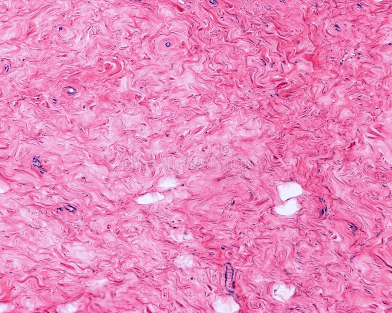 Human Mammary Gland. Breast Stroma Stock Photo - Image of microscopic ...