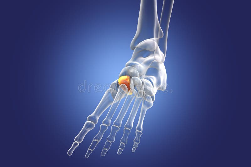 Intermediate Cuneiform Bone of the Foot, 3D Illustration Stock ...
