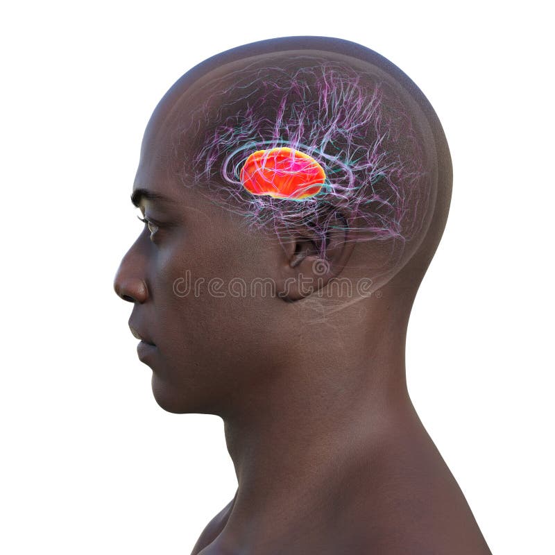 Internal Capsule, 3D Illustration. Highlighted in Red within the Human ...