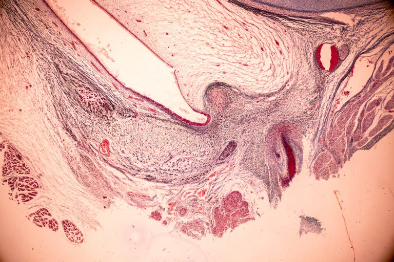 Internal Ear, Foetal Under the Microscope in Lab. Stock Photo - Image ...