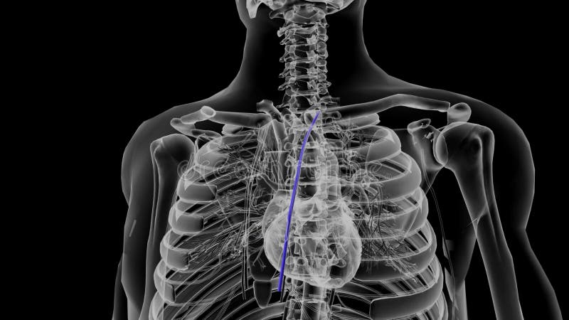 Cardiac Catheterization, Stent into Body Stock Illustration ...