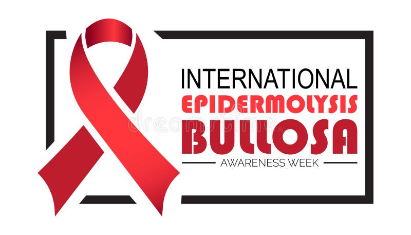 International Epidermolysis Bullosa Awareness Week is Observed Every ...