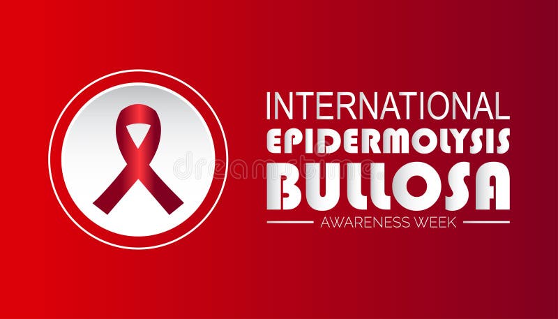 International Epidermolysis Bullosa Awareness Week is Observed Every ...