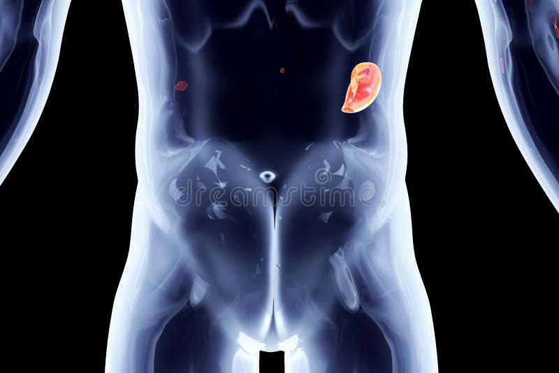 Interne Organen - Milt stock illustratie. Illustration of ontsteking ...