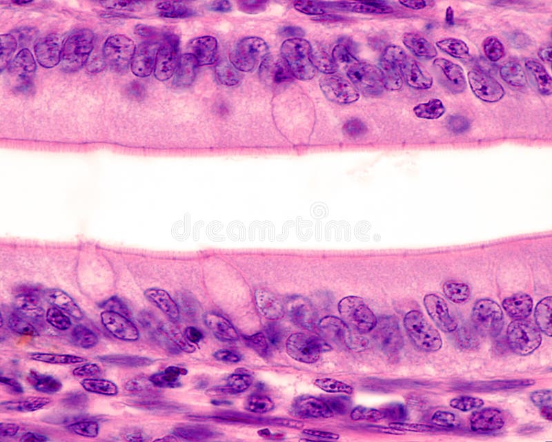 Darmepitheel. Borstelzoom stock afbeelding. Image of grens - 93292225