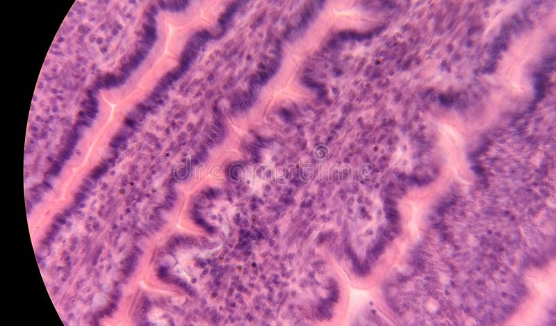 Intestinal Villi Under a Microscope Stock Photo - Image of anatomy ...
